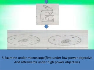 Stool Examination for Routine Practice | PPTX