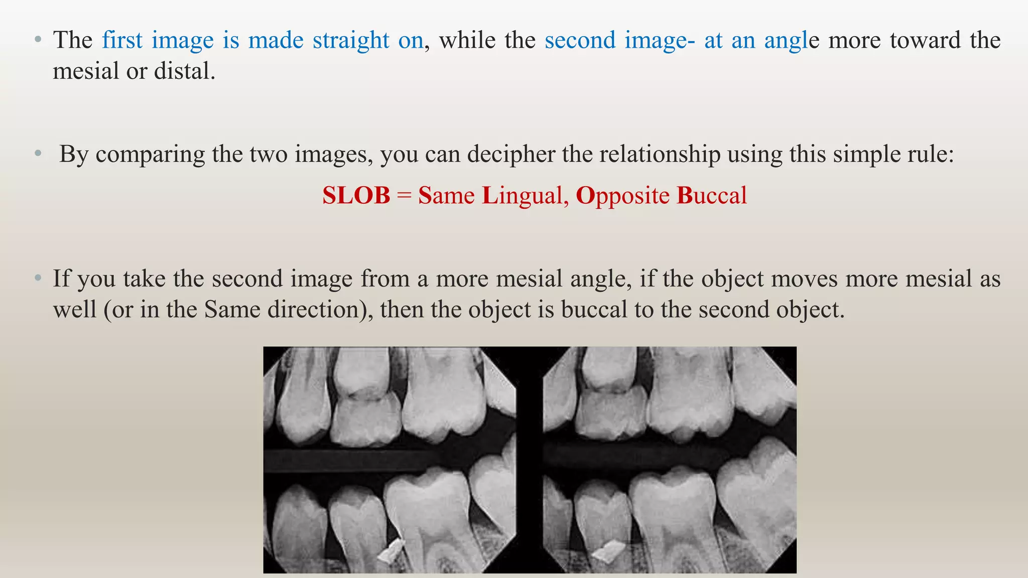 Radiographic Considerations in Implants | PPTX