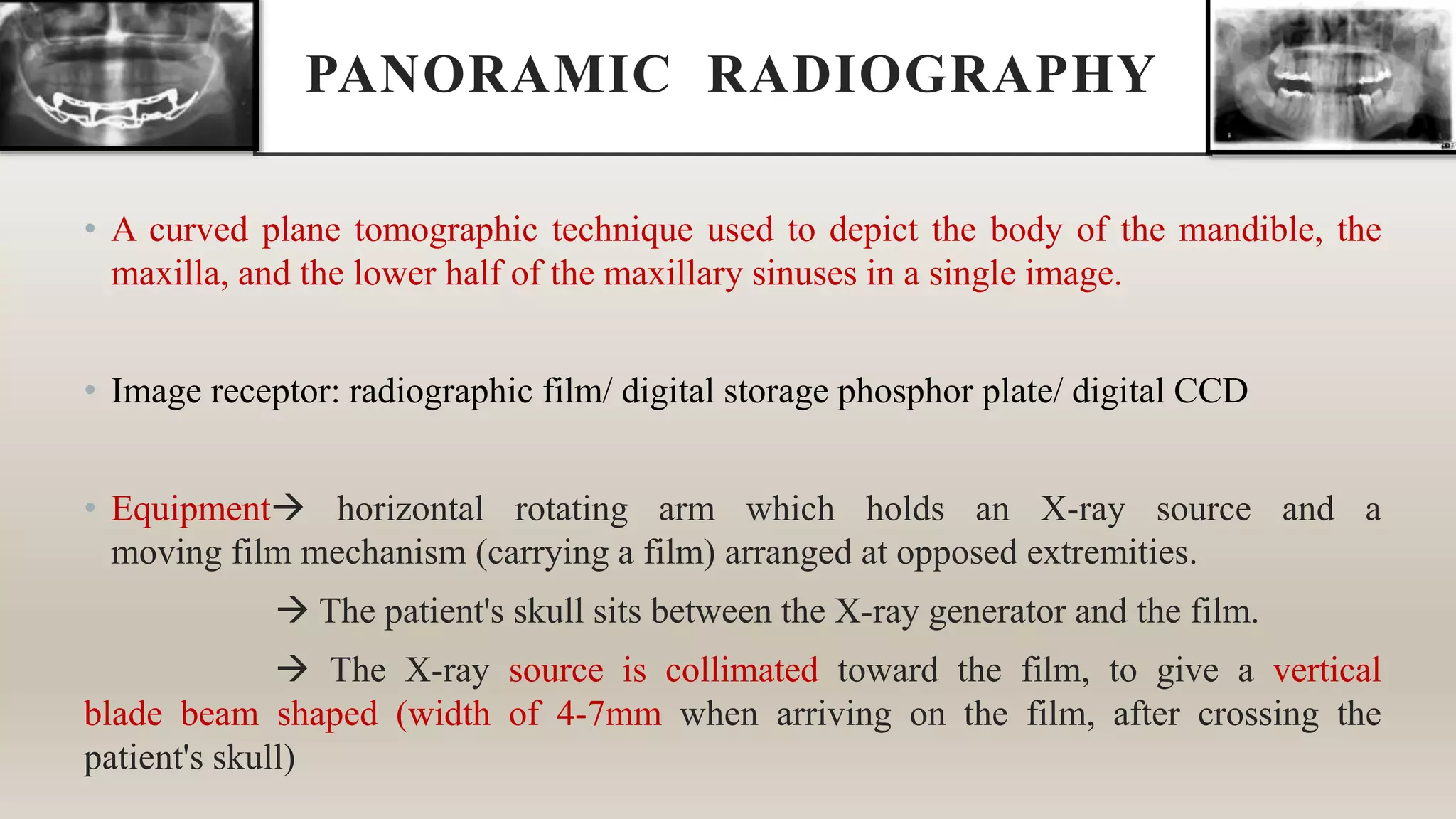 Radiographic Considerations in Implants | PPTX