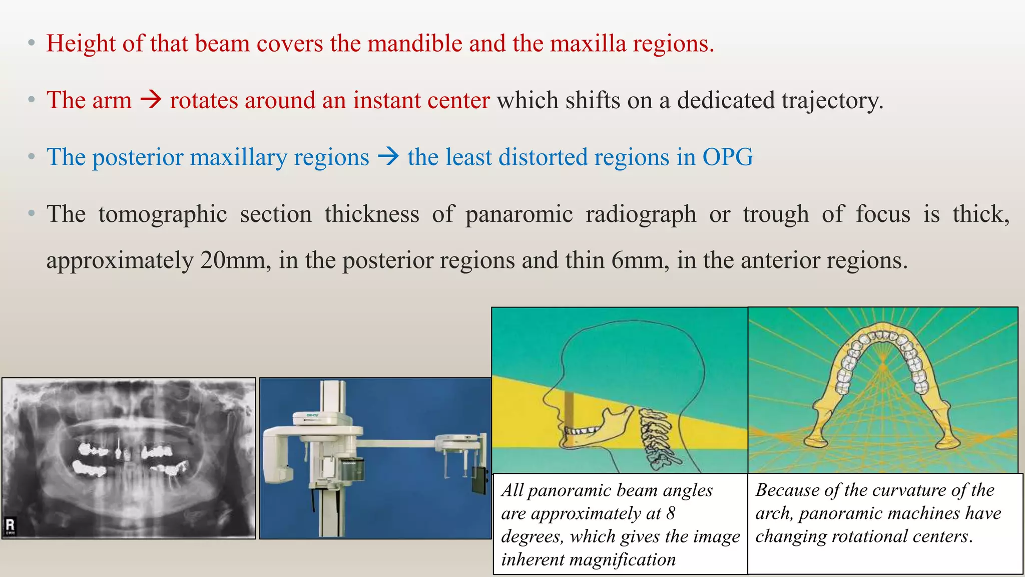 Radiographic Considerations in Implants | PPTX