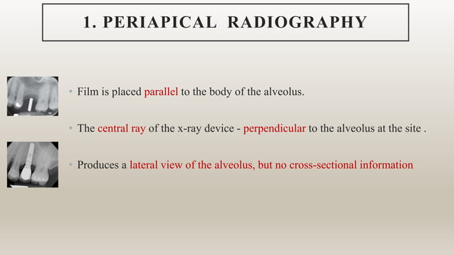 Radiographic Considerations in Implants | PPTX | Dental Health ...