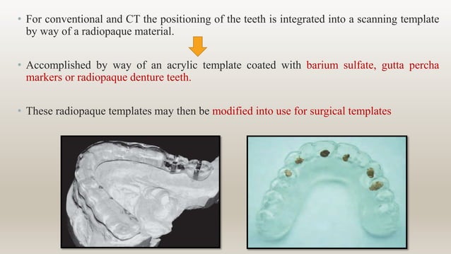 Radiographic Considerations in Implants | PPTX | Dental Health ...