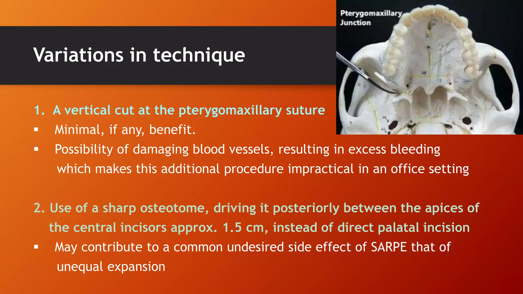 Orthognathic Surgical Procedure on non-growing patients with maxillary ...