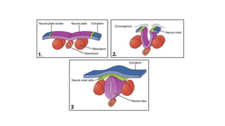 Neural Tube Defects for Undergraduate Medical Students | PPT