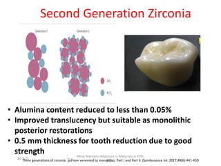 Advances in Materials in Fixed Partial Dentures | PDF