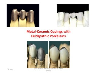 Advances in Materials in Fixed Partial Dentures | PDF