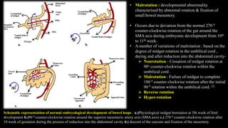 MIDGUT VOLVULUS AND MALROTATION : AN UNUSUAL CAUSE OF INTESTINAL ...