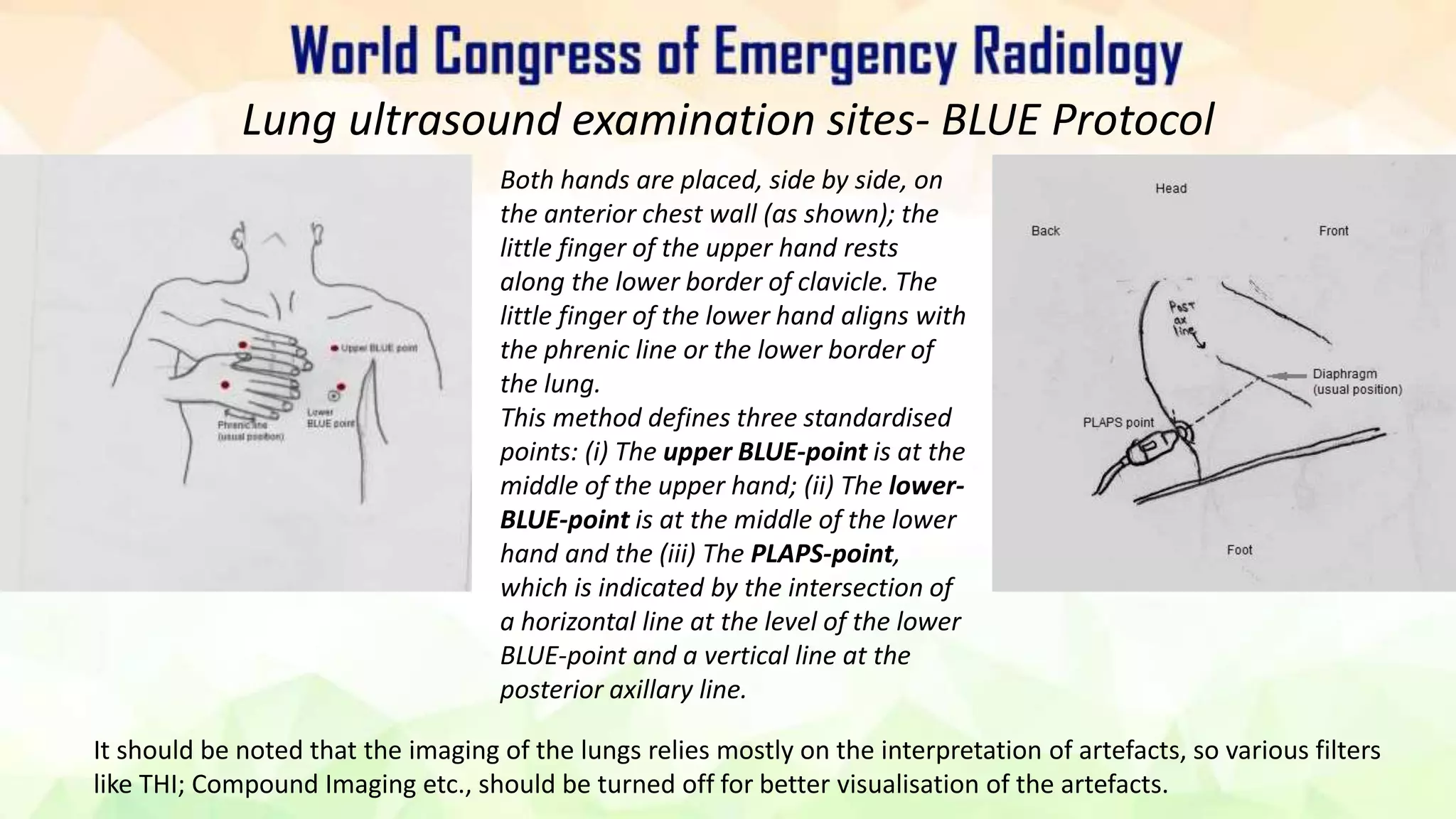Normal Lung Ultrasound in Emergency: Technique and what to expect | PPT