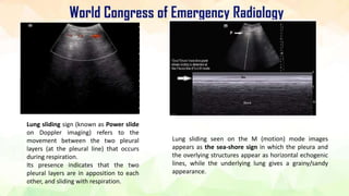 Normal Lung Ultrasound in Emergency: Technique and what to expect | PPT