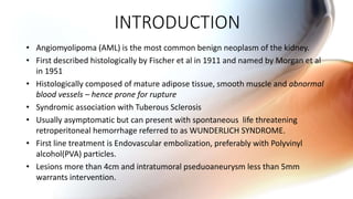 ‘NOT SO WONDERFUL’ WUNDERLICH SYNDROME – CASE REPORT OF A RUPTURED ...