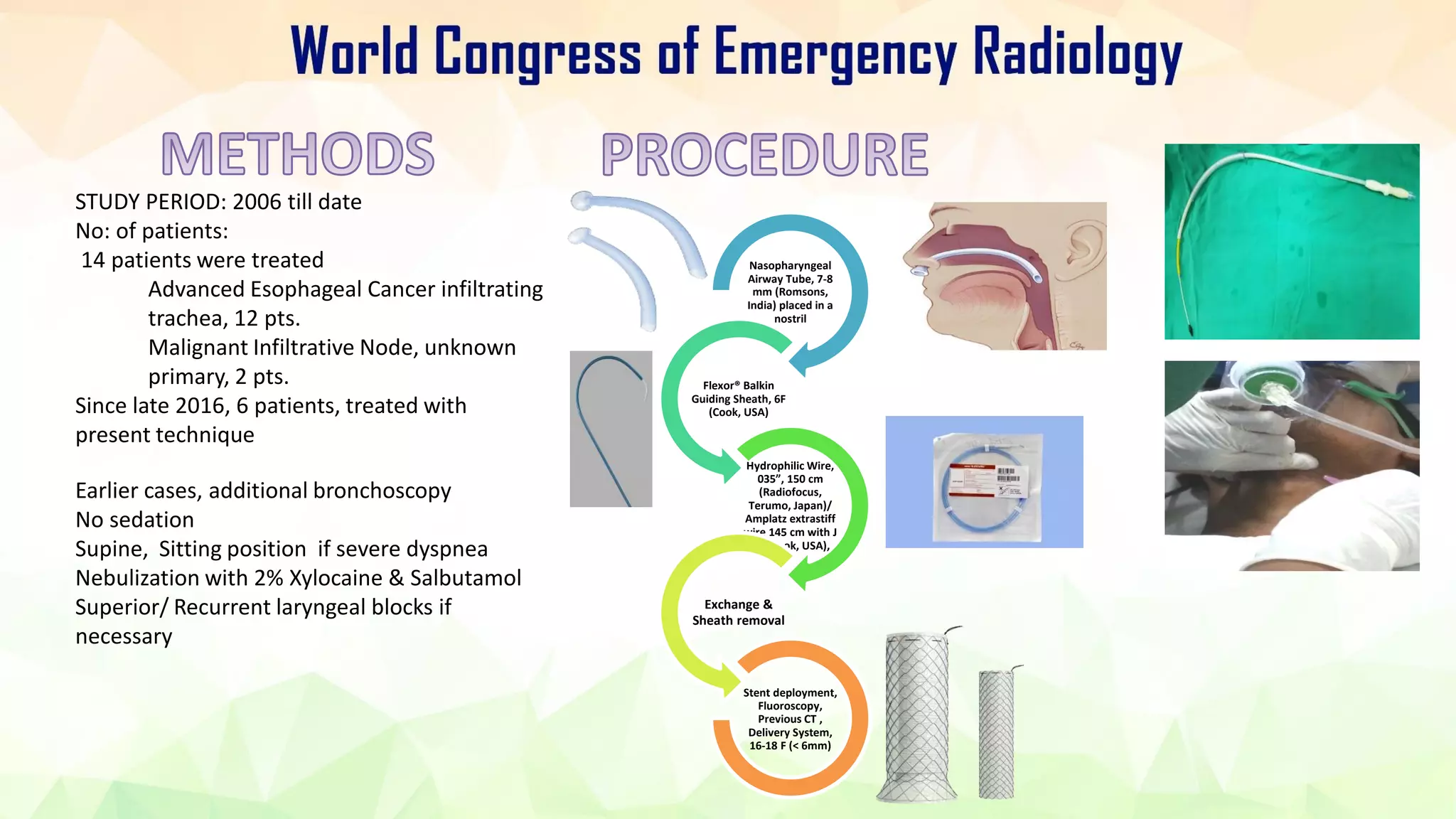 TRACHEO BRONCHIAL STENTING IN MALIGNANT AIRWAYS: a simple rapid trans ...