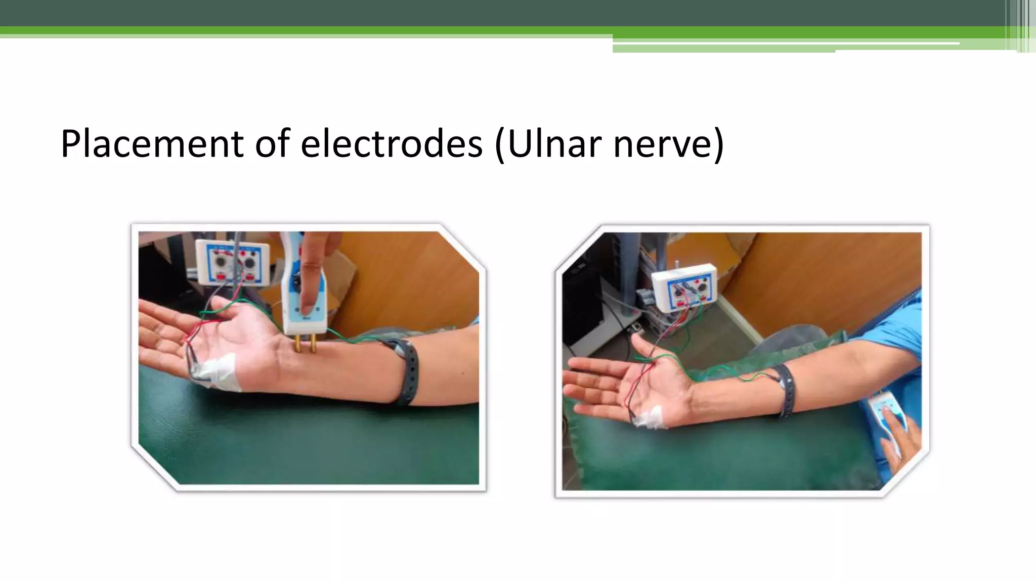 Fundamentals of Nerve conduction studies and its Interpretations | PPTX ...