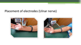 Fundamentals of Nerve conduction studies and its Interpretations | PPTX