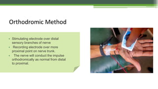 Fundamentals of Nerve conduction studies and its Interpretations | PPTX