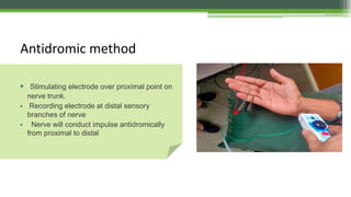 Fundamentals of Nerve conduction studies and its Interpretations | PPTX