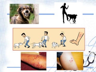 Dr.k yashoda rabies presentation | PPT