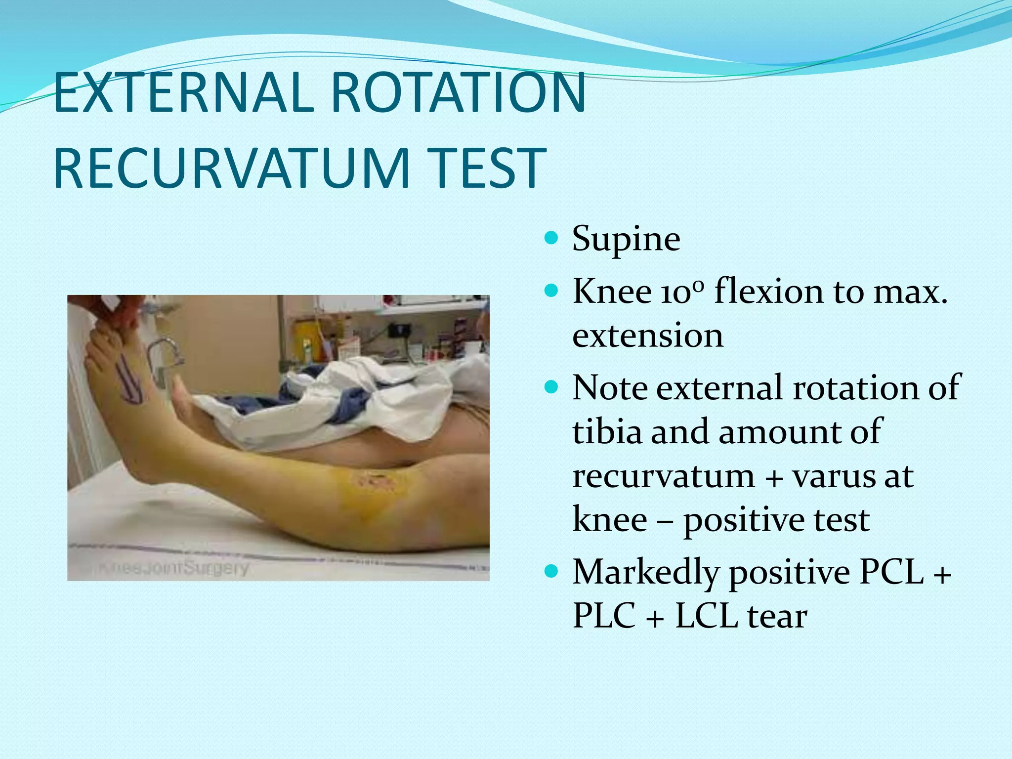 Dr. Aditya shrimal sir ppt knee examination | PPT