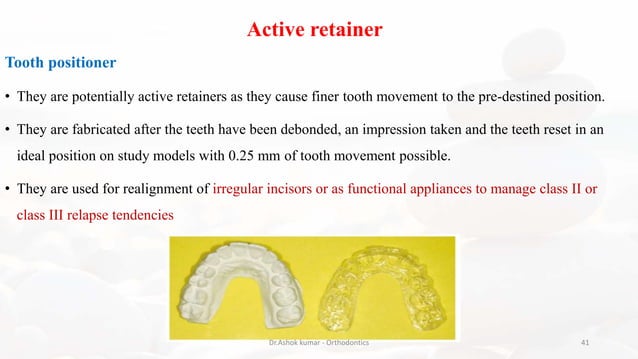 Stability Retention and Relapse in orthodontics | PPTX | Dental Health ...