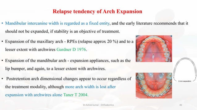 Stability Retention and Relapse in orthodontics | PPTX | Dental Health ...