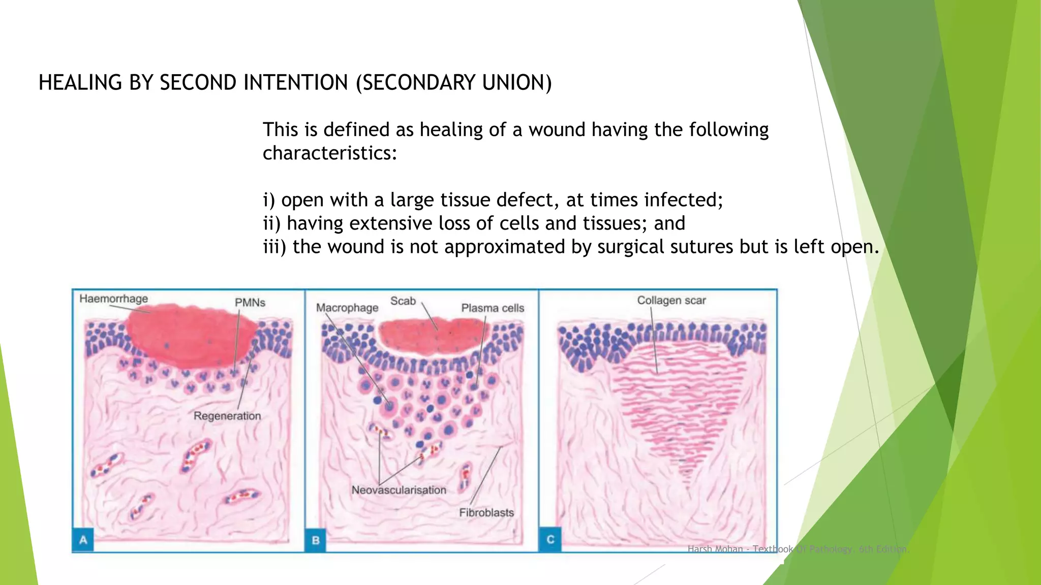 wound healing seminar | PPTX