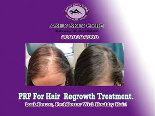 Dr. anita rath is best for hair transplant specilaist in bhubaneswar ...