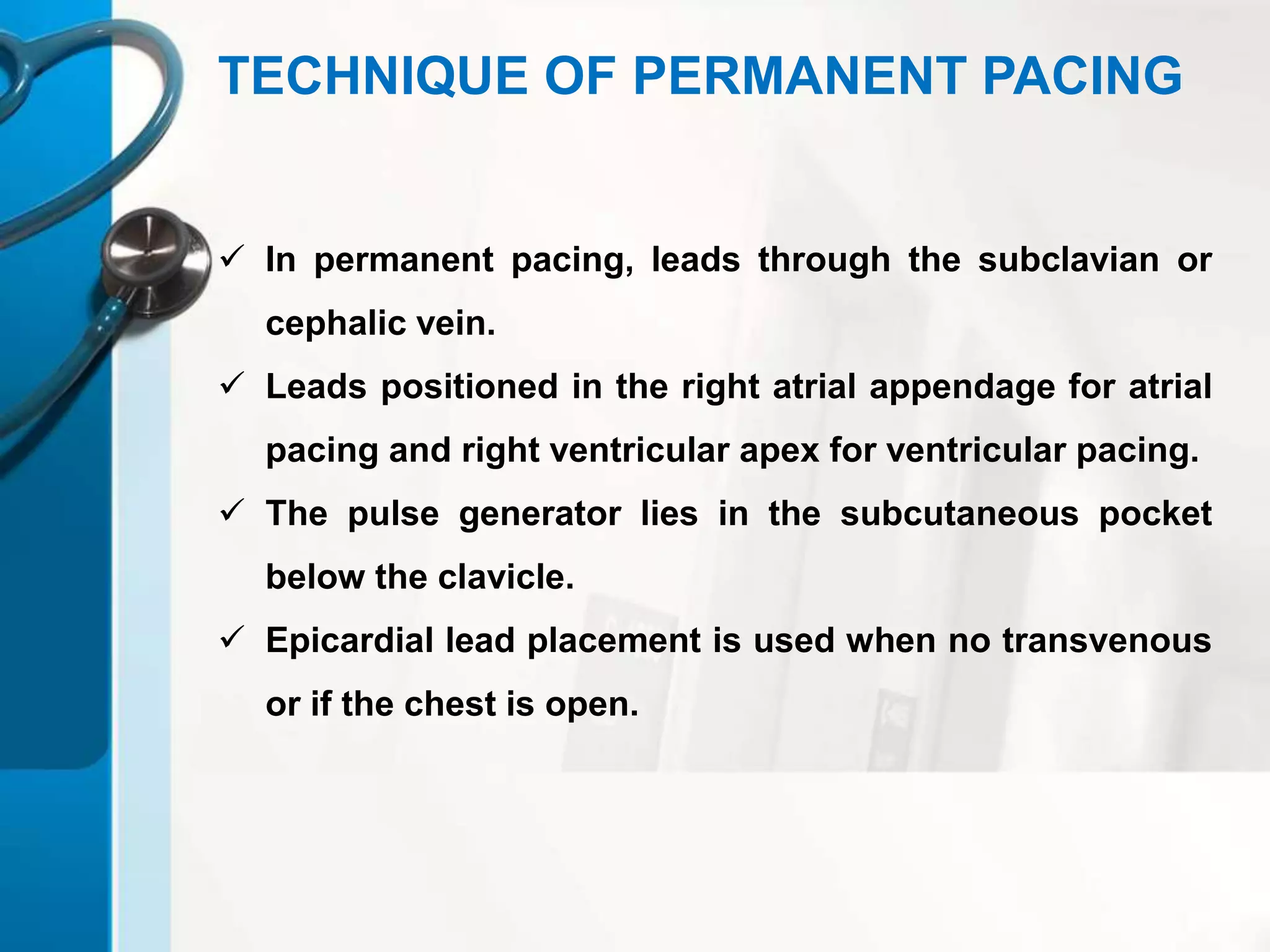 PACEMAKER by Dr.Sravani Vishnubhatla | PPTX