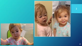 clinical approach to pediatric proteinuria | PDF