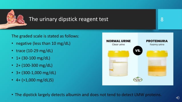 clinical approach to pediatric proteinuria | PDF | Medical Tests ...