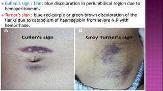 Dr. Amit Annand Acute Pancreatitis.pptx