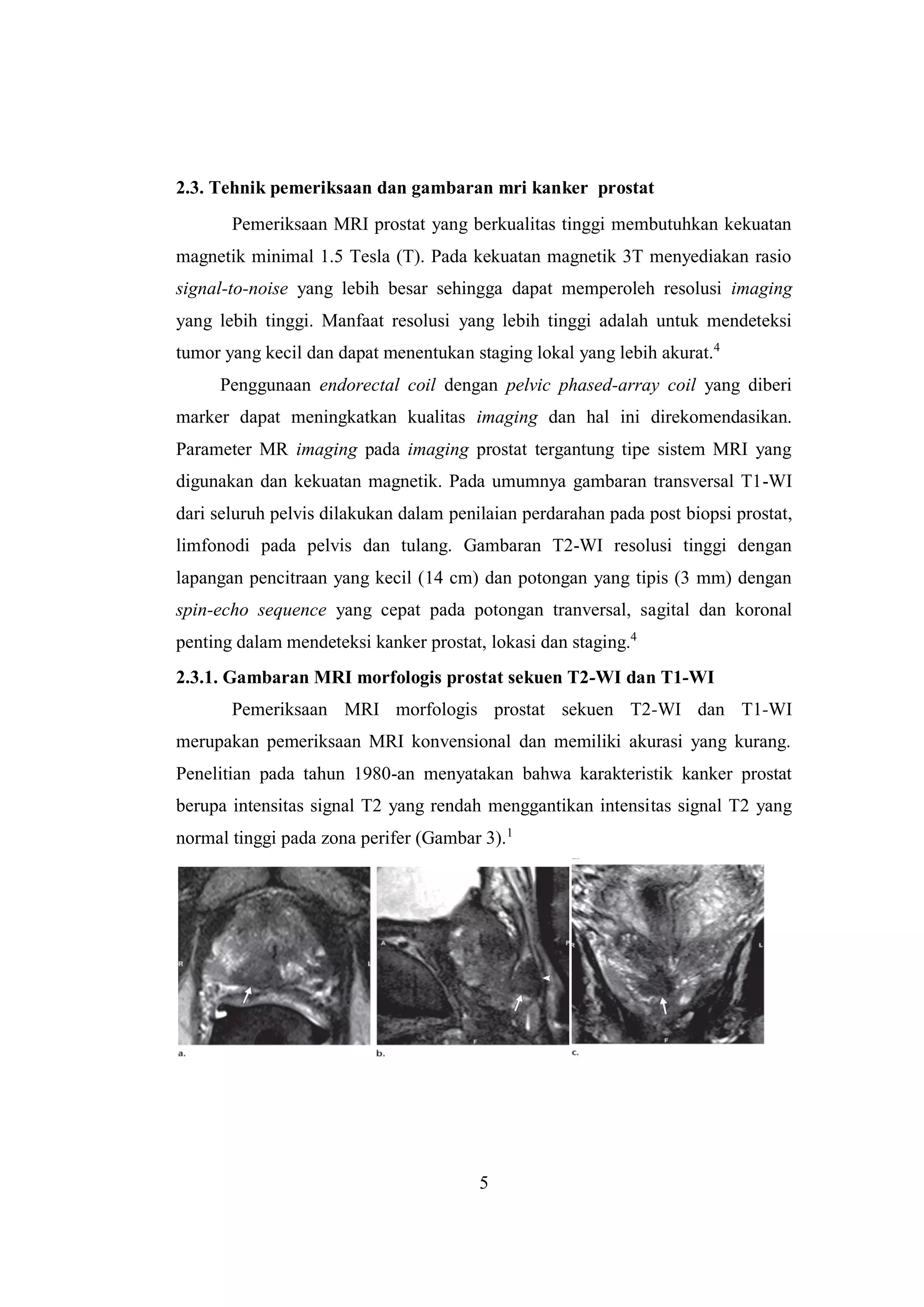 dr. Adnan (Referat) Gambaran MRI Kanker Prostat.pdf
