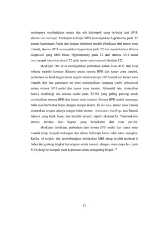 dr. Adnan (Referat) Gambaran MRI Kanker Prostat.pdf