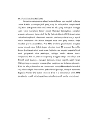 dr. Adnan (Referat) Gambaran MRI Kanker Prostat.pdf