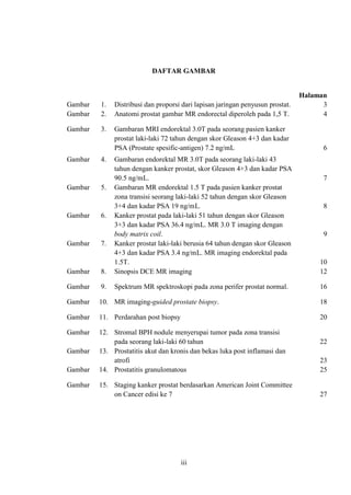 dr. Adnan (Referat) Gambaran MRI Kanker Prostat.pdf