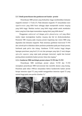 dr. Adnan (Referat) Gambaran MRI Kanker Prostat.pdf