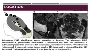 dr. Apri PPT (Jurnal) Imaging Spectrum Of Benign Uterine Disease And ...