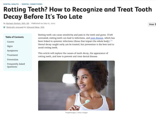 Rotting Teeth? How to Recognize and Treat Tooth Decay Before It's Too ...