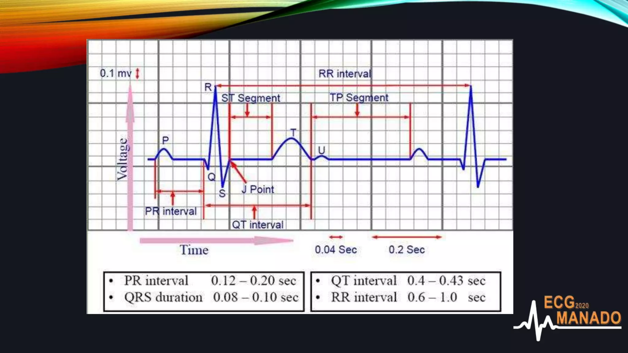 dr. BS - Basic cardiac EP ECG course.pptx