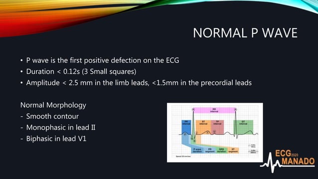 dr. BS - Basic cardiac EP ECG course.pptx