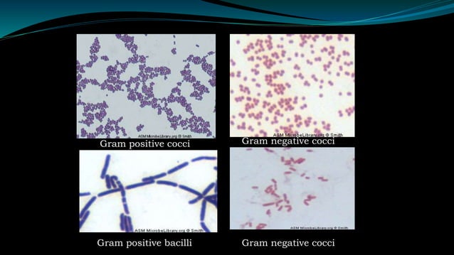 Basics of gram staining | PPTX