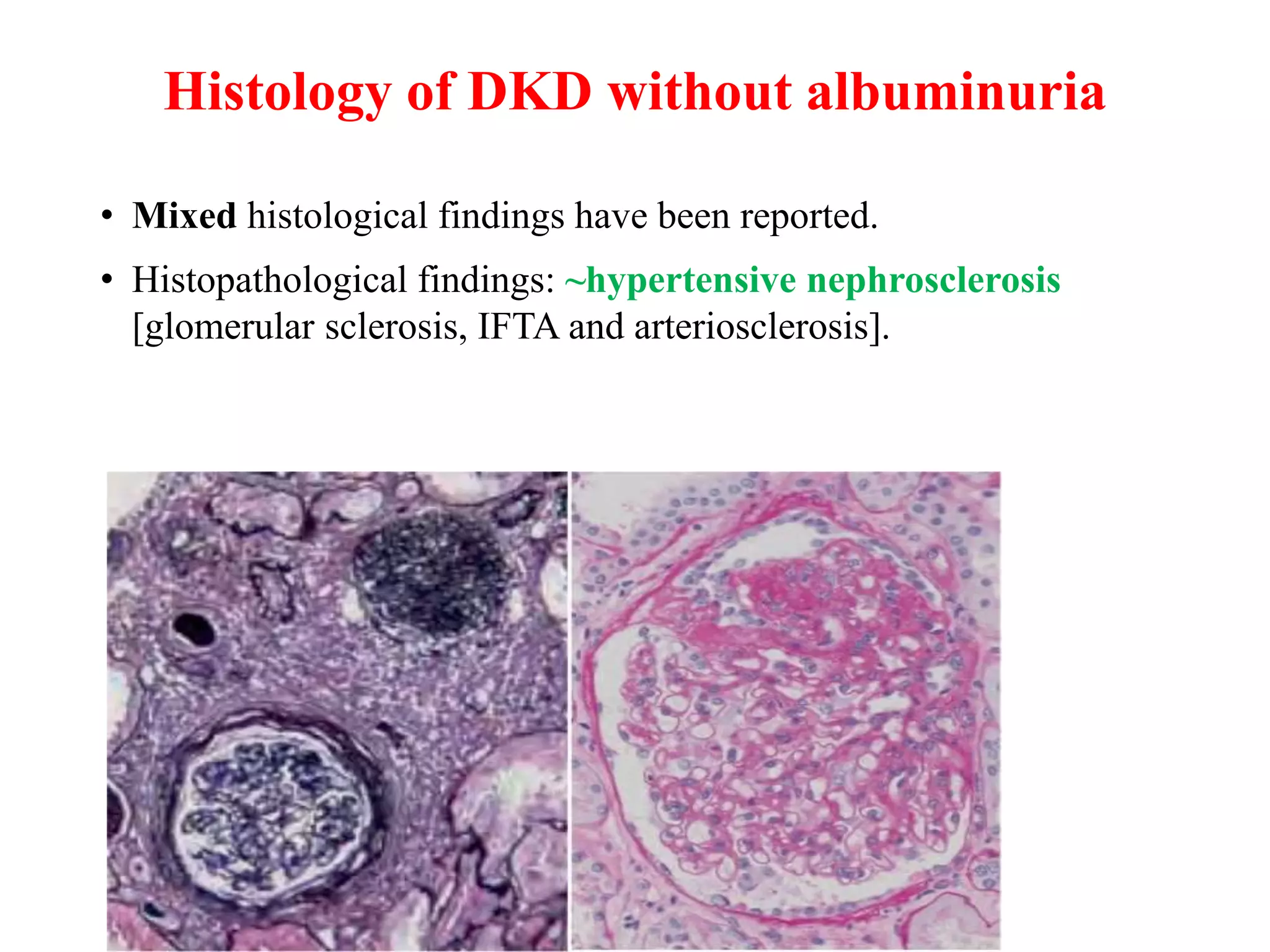 Changing histology in diabetic kidney disease | PPTX