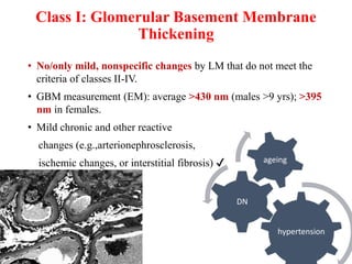 Glomerular Basement Membrane Lm