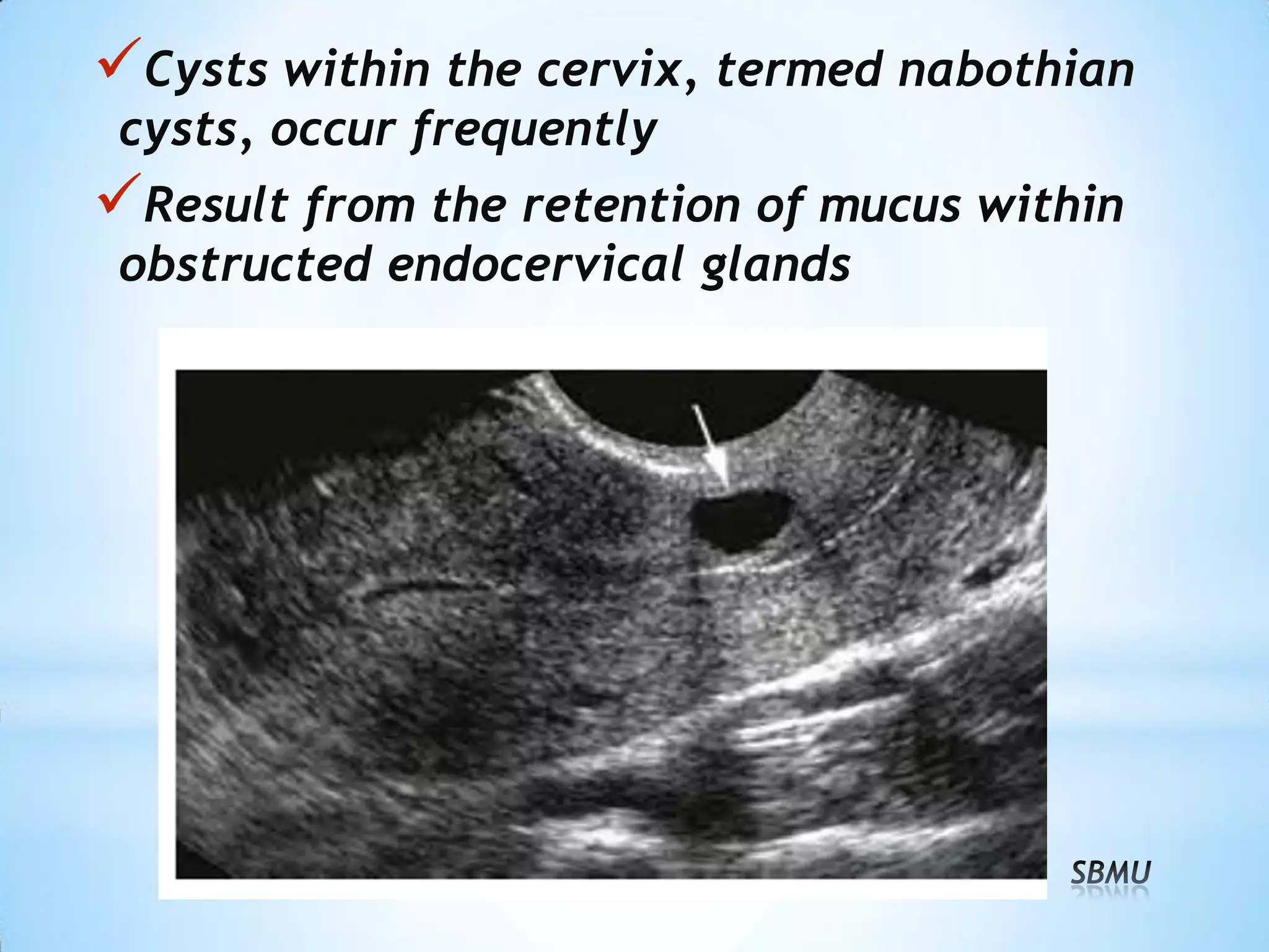 Dr.Nazari.Normal_Pelvic_Ultrasound.pdf
