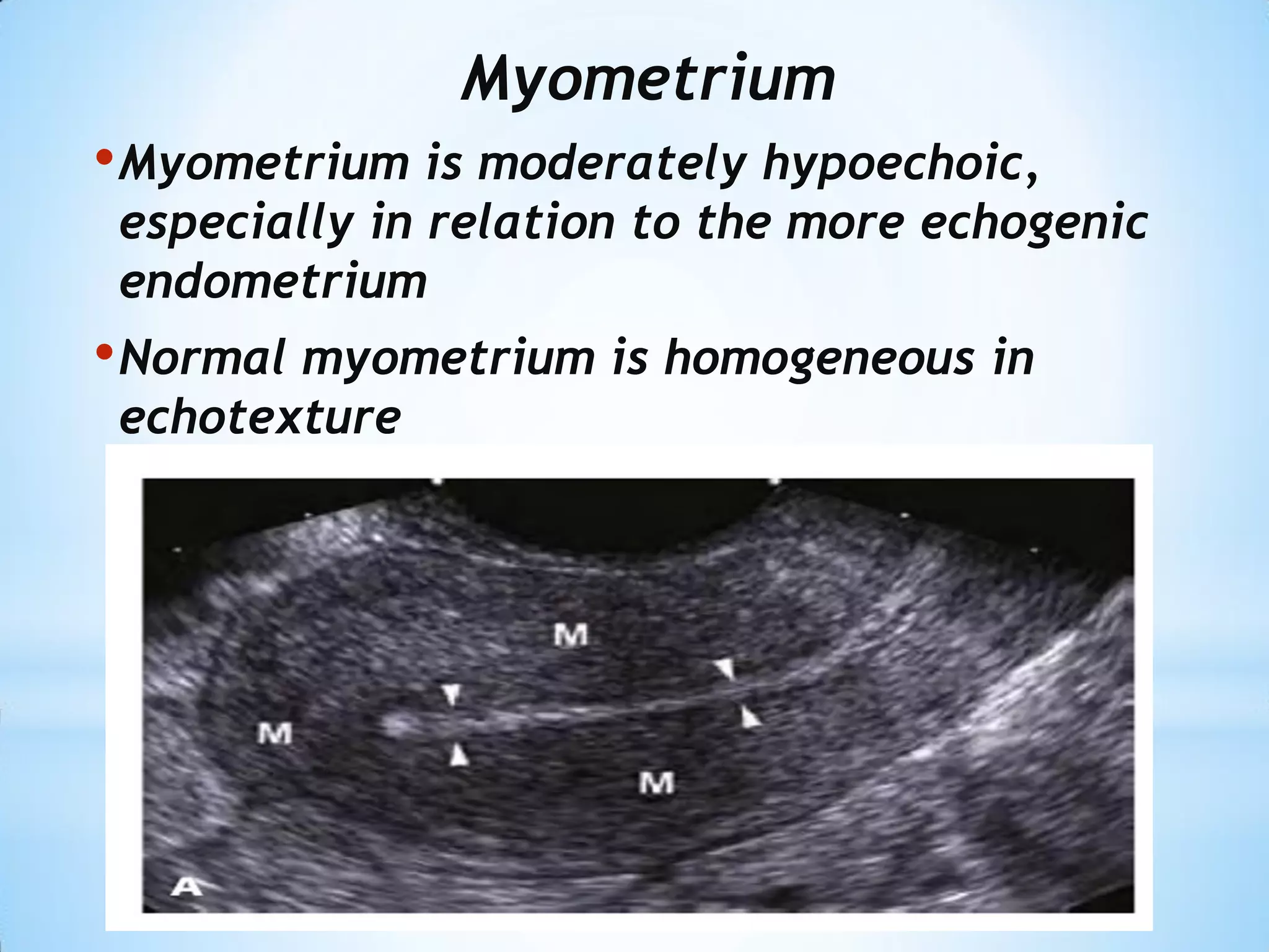 Dr.Nazari.Normal_Pelvic_Ultrasound.pdf