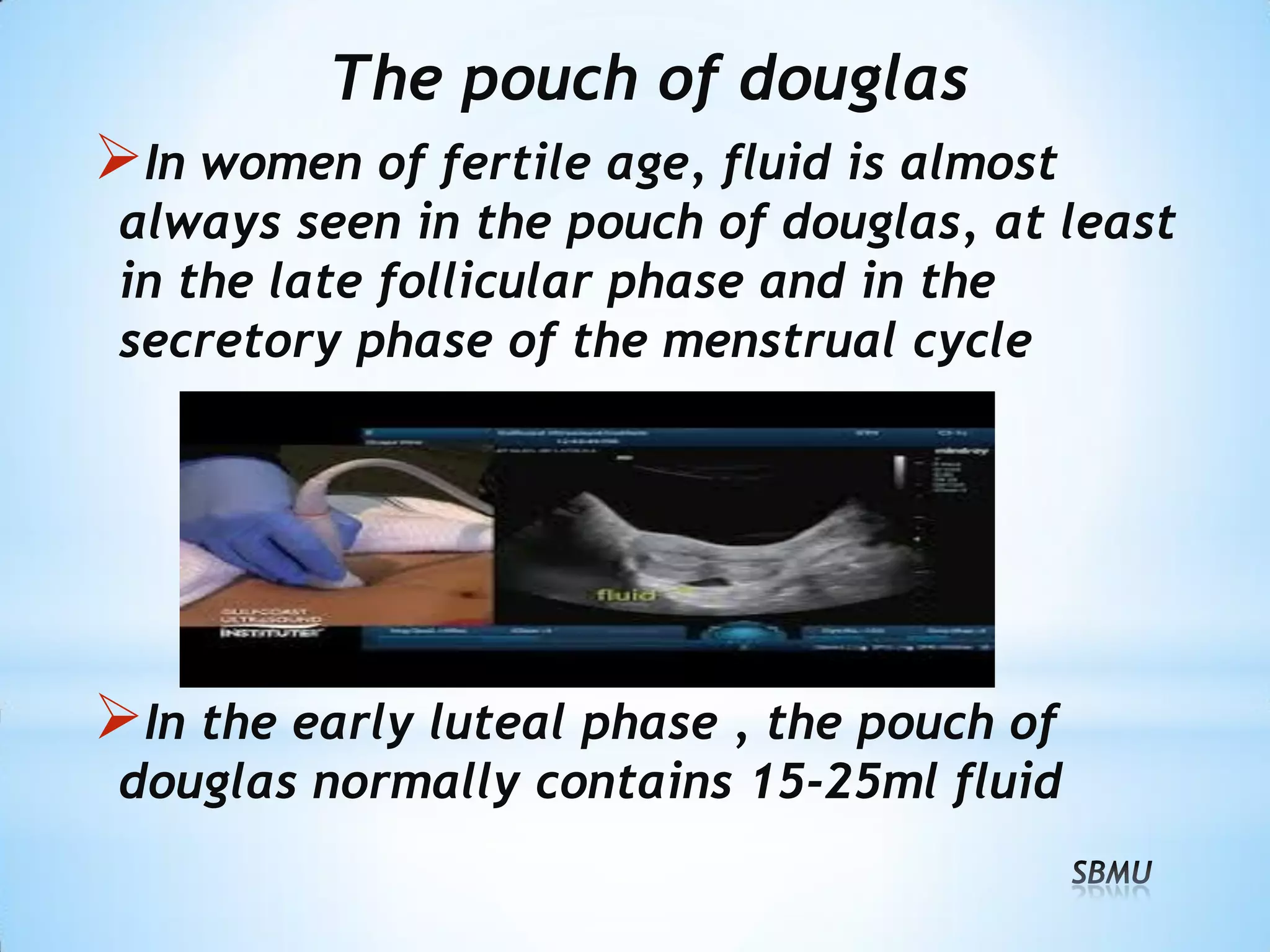 Dr.Nazari.Normal_Pelvic_Ultrasound.pdf