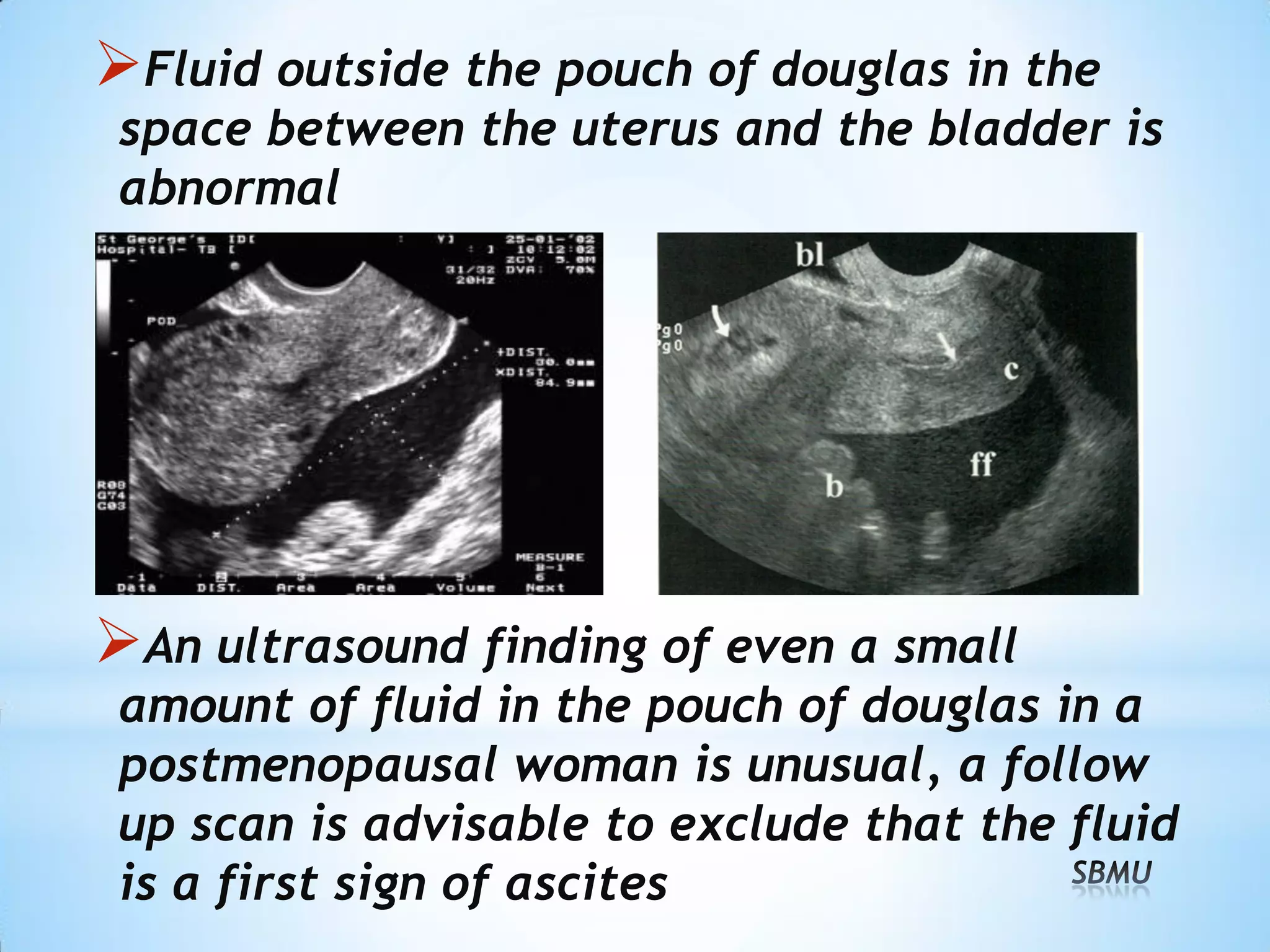 Dr.Nazari.Normal_Pelvic_Ultrasound.pdf