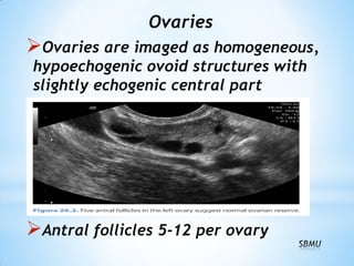 Dr.Nazari.Normal_Pelvic_Ultrasound.pdf