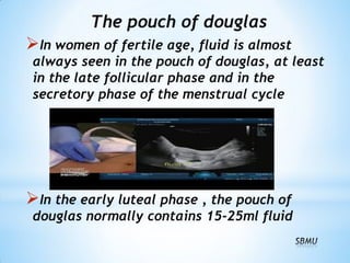 Dr.Nazari.Normal_Pelvic_Ultrasound.pdf