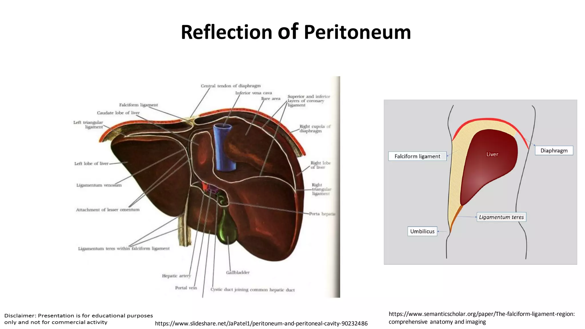 (Peritoneum anatomy .pdf