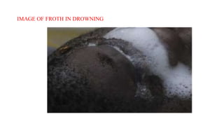 pathophysiology of drowning.pptx Dr. Haricharan MD RIMS Imphal . MBBS ...