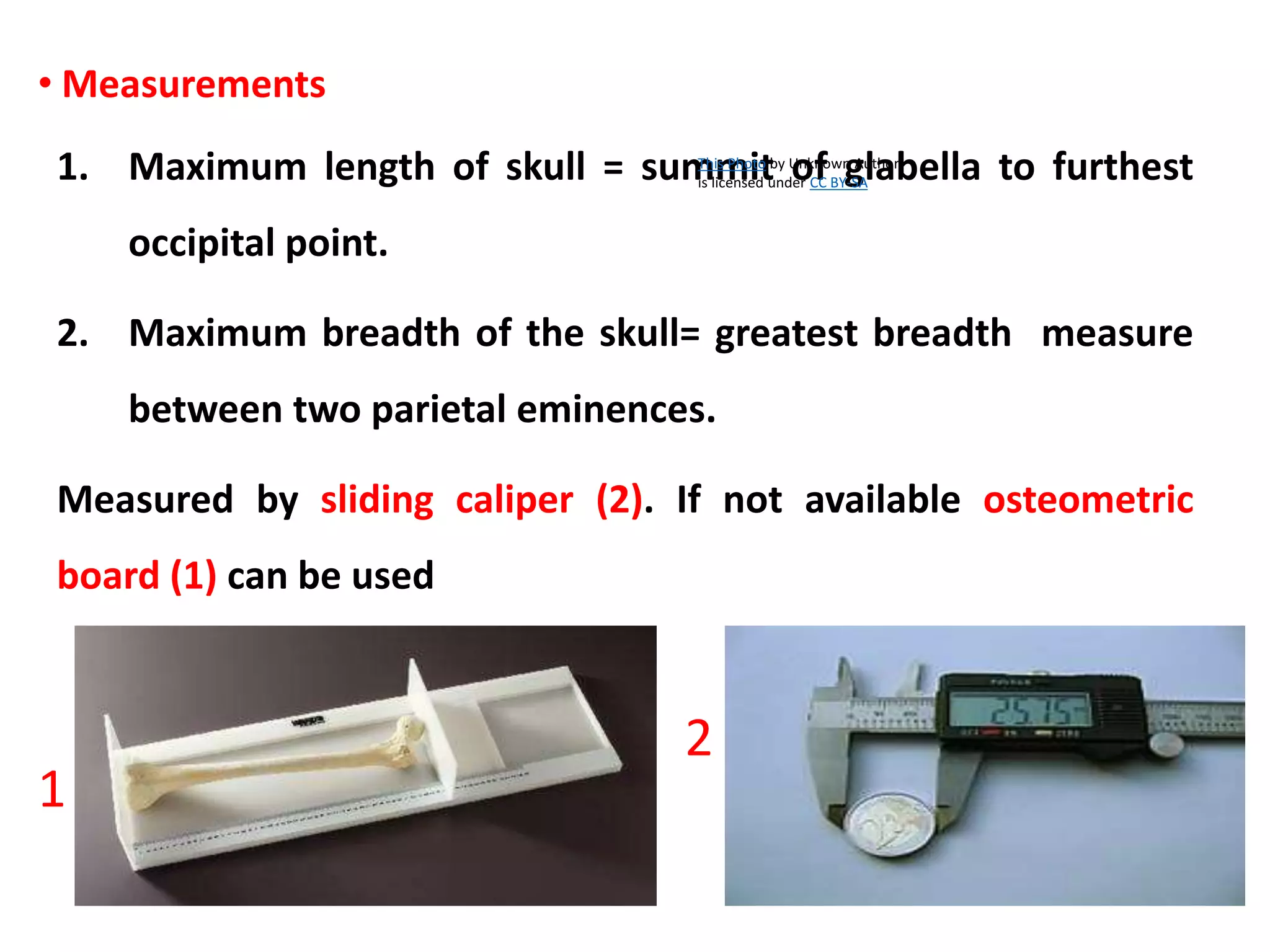 DETERMINATION OF RACE FROM HUMAN REMAINS.pptx Dr. Haricharan MD RIMS ...
